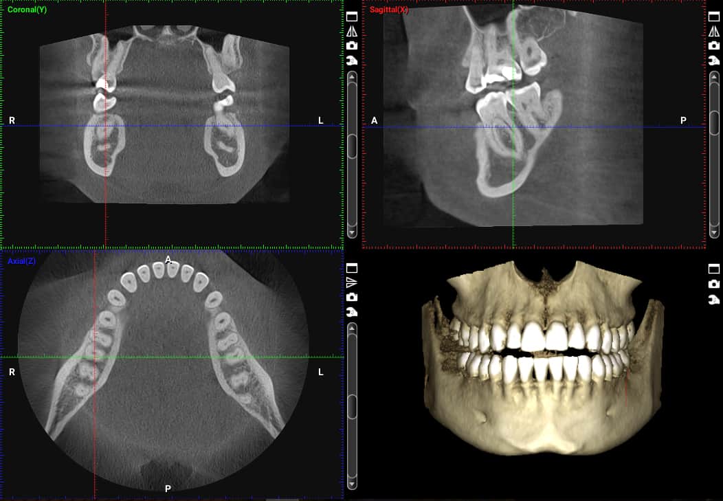 Digital X-Rays & Intraoral Cameras - Cranberry Dental Studio