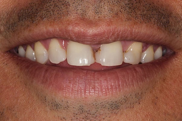 Smile Gallery - Cranberry Dental Studio